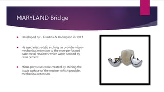 Resin bonded FPD | PPTX