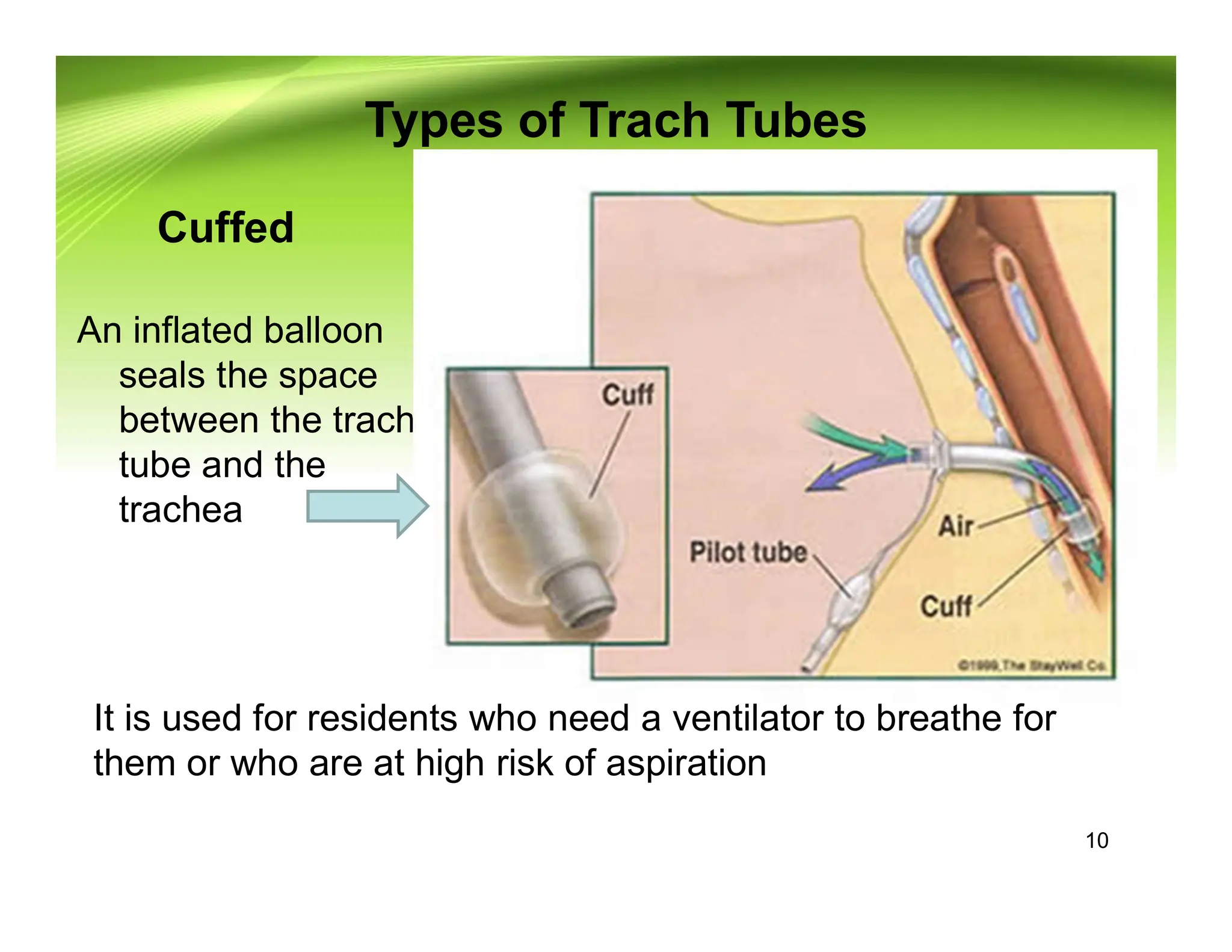 PPT-TRACHEOSTOMY.pdfkkkkjjjjjjjjjjjjjhhhhhh | PDF