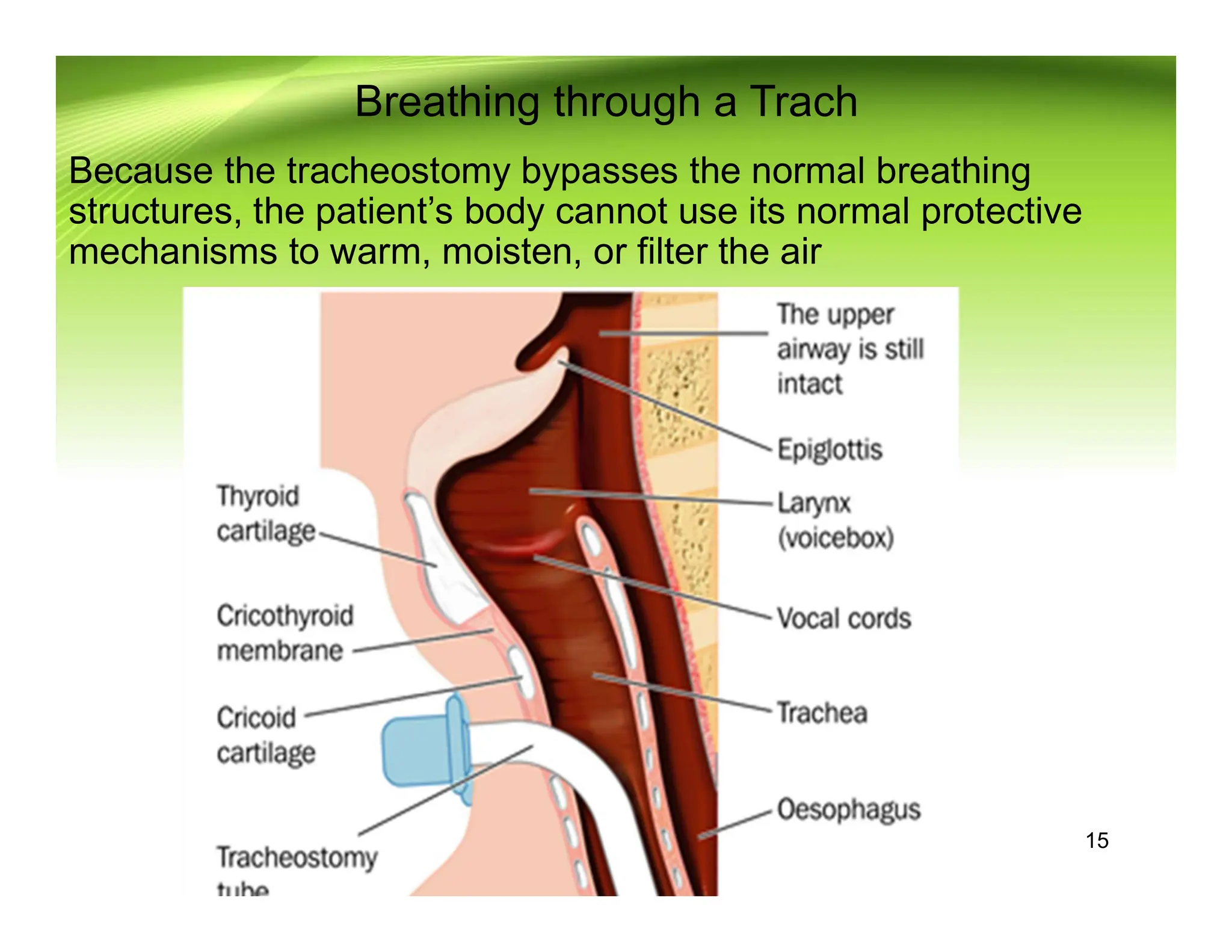 PPT-TRACHEOSTOMY.pdfkkkkjjjjjjjjjjjjjhhhhhh | PDF
