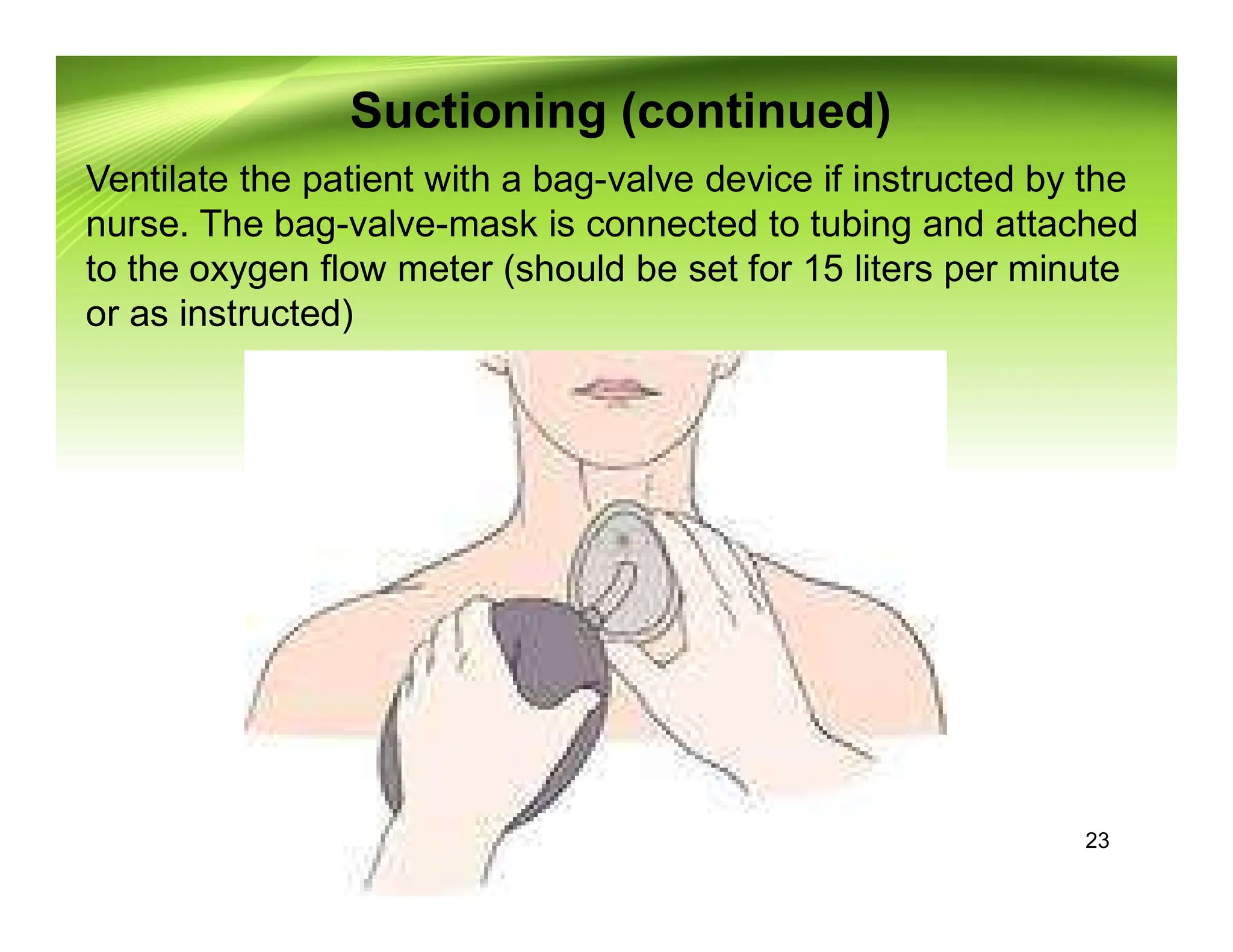 PPT-TRACHEOSTOMY.pdfkkkkjjjjjjjjjjjjjhhhhhh | PDF