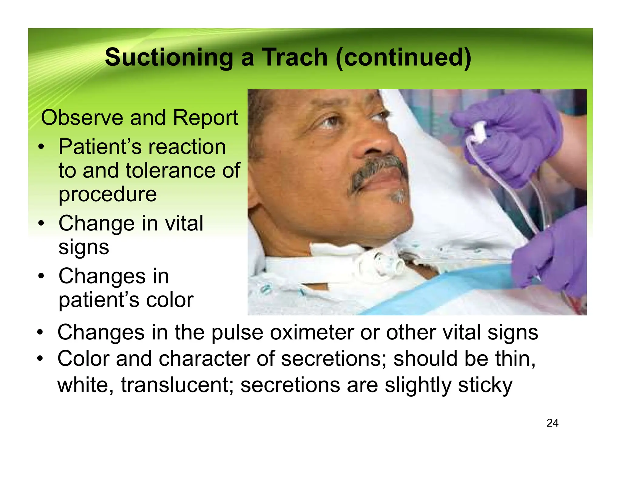 PPT-TRACHEOSTOMY.pdfkkkkjjjjjjjjjjjjjhhhhhh | PDF