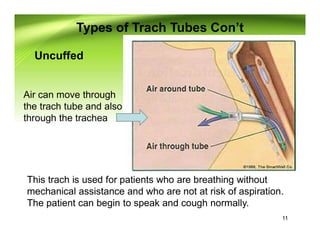 PPT-TRACHEOSTOMY.pdfkkkkjjjjjjjjjjjjjhhhhhh | PDF