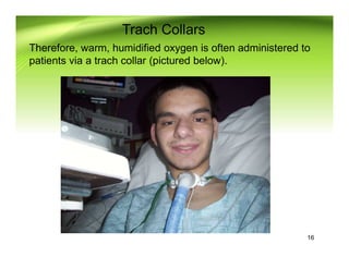 PPT-TRACHEOSTOMY.pdfkkkkjjjjjjjjjjjjjhhhhhh | PDF