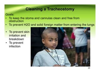 PPT-TRACHEOSTOMY.pdfkkkkjjjjjjjjjjjjjhhhhhh | PDF