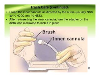 PPT-TRACHEOSTOMY.pdfkkkkjjjjjjjjjjjjjhhhhhh | PDF