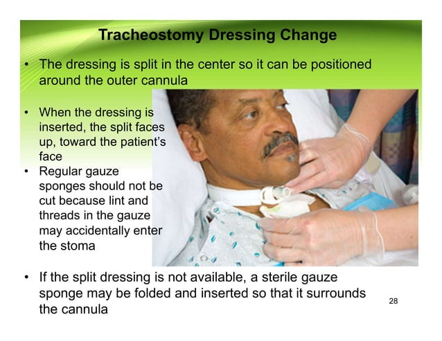 PPT-TRACHEOSTOMY.pdfkkkkjjjjjjjjjjjjjhhhhhh | PDF