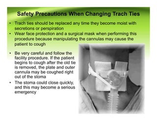 PPT-TRACHEOSTOMY.pdfkkkkjjjjjjjjjjjjjhhhhhh | PDF
