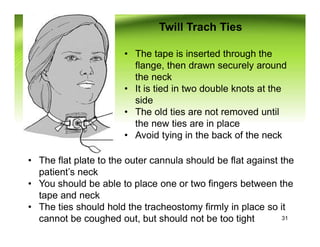 PPT-TRACHEOSTOMY.pdfkkkkjjjjjjjjjjjjjhhhhhh | PPT