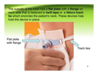 PPT-TRACHEOSTOMY.pdfkkkkjjjjjjjjjjjjjhhhhhh | PPT