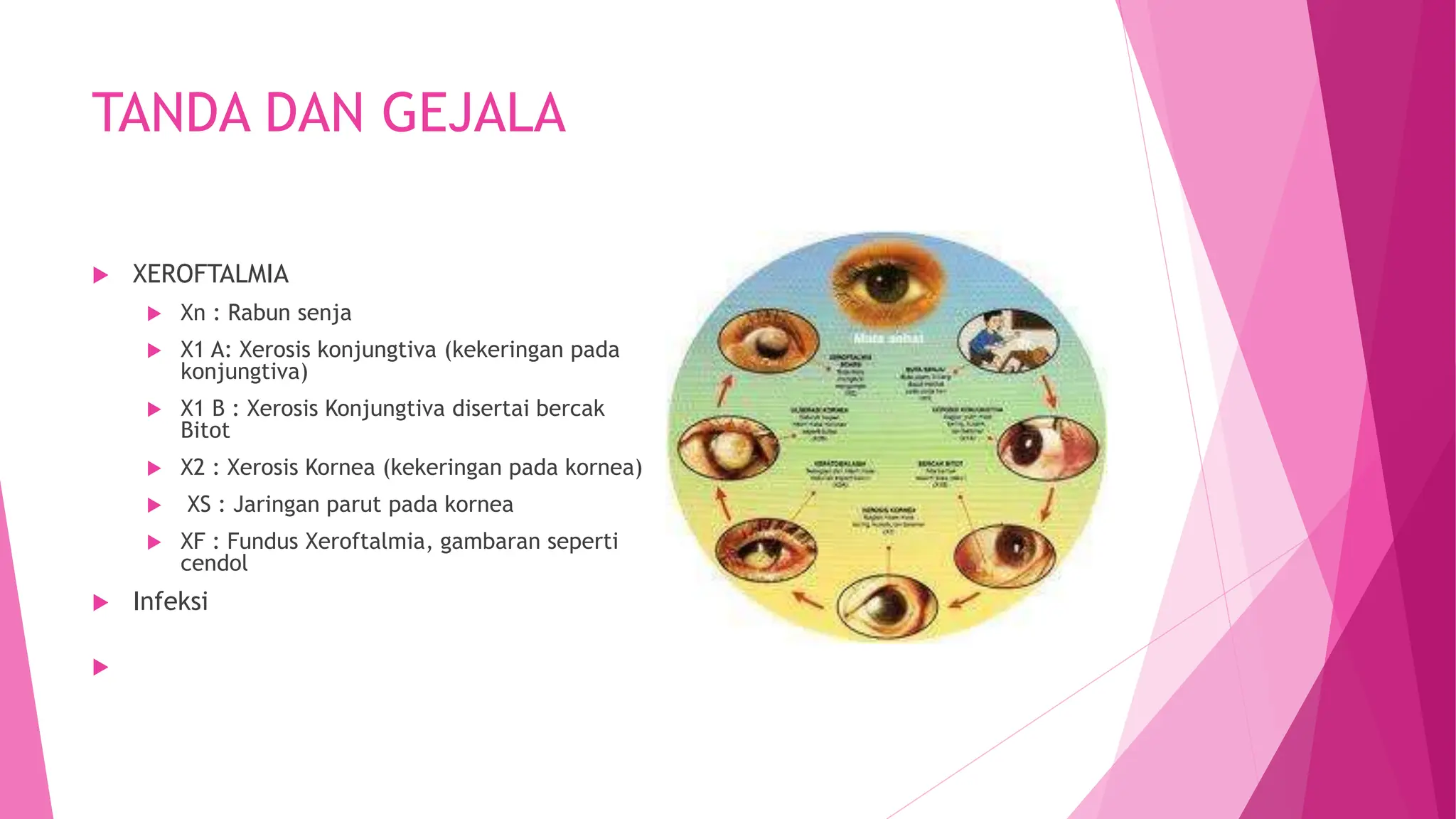 PPT-UEU-Patofisiologi-Penyakit-Menular-Defisiensi-6 (1).pptx