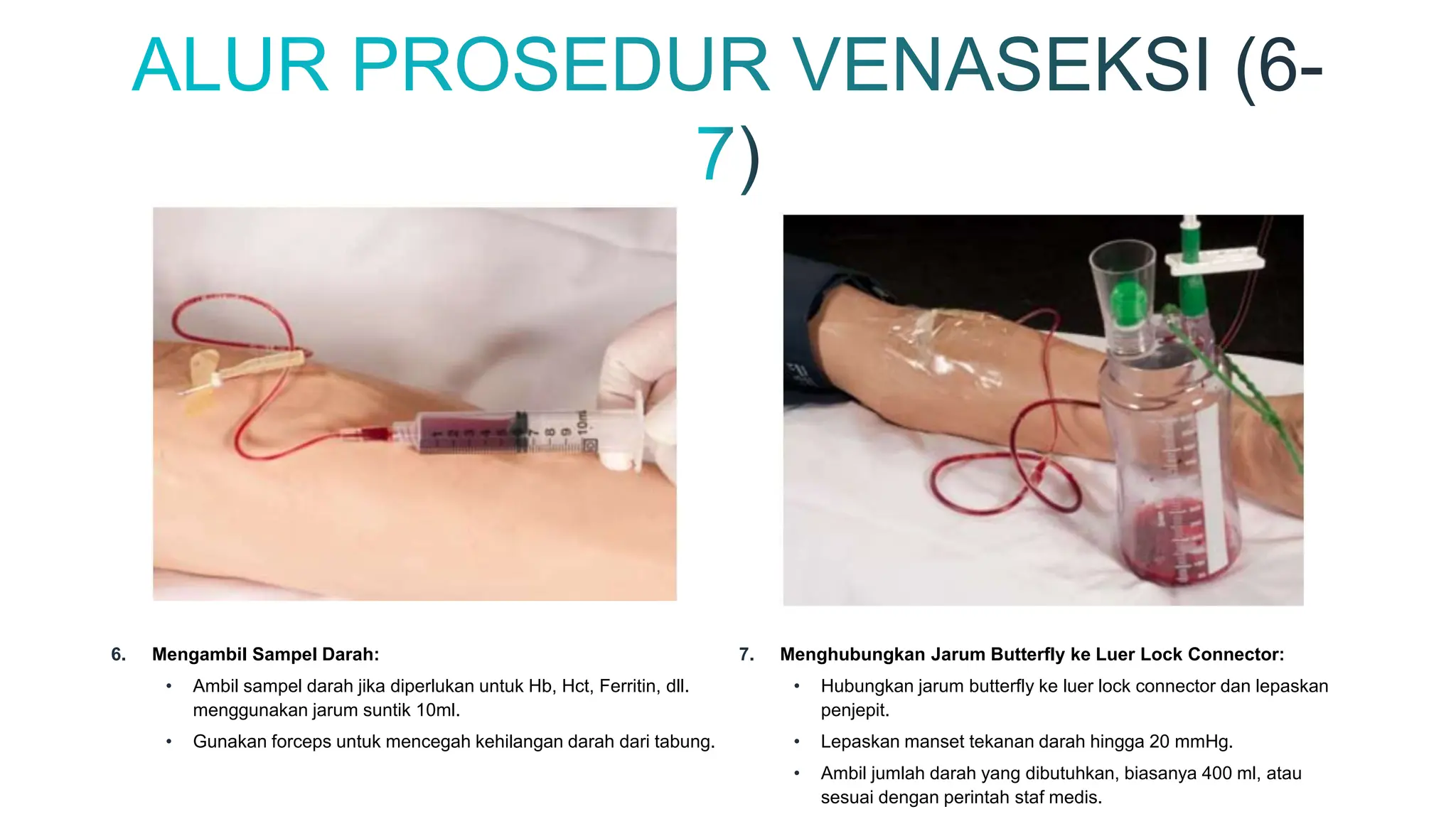 Paparan tentang Vena Seksi oleh Pisok Awuy | PPTX