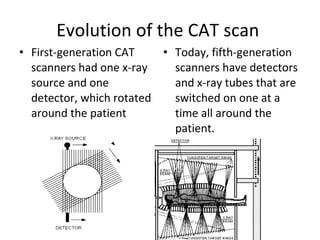 CAT scan 3 | PPT