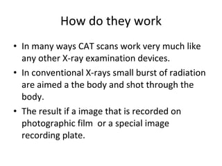 CAT scan 3 | PPT