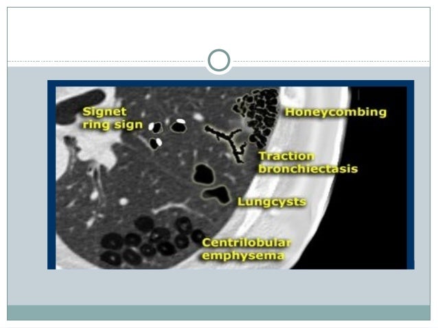 lung hrct patterns