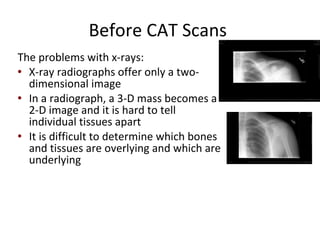 CAT scan Final | PPT | Medical Tests | Medical Health