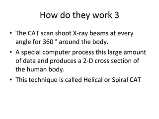 CAT scan Final | PPT | Medical Tests | Medical Health