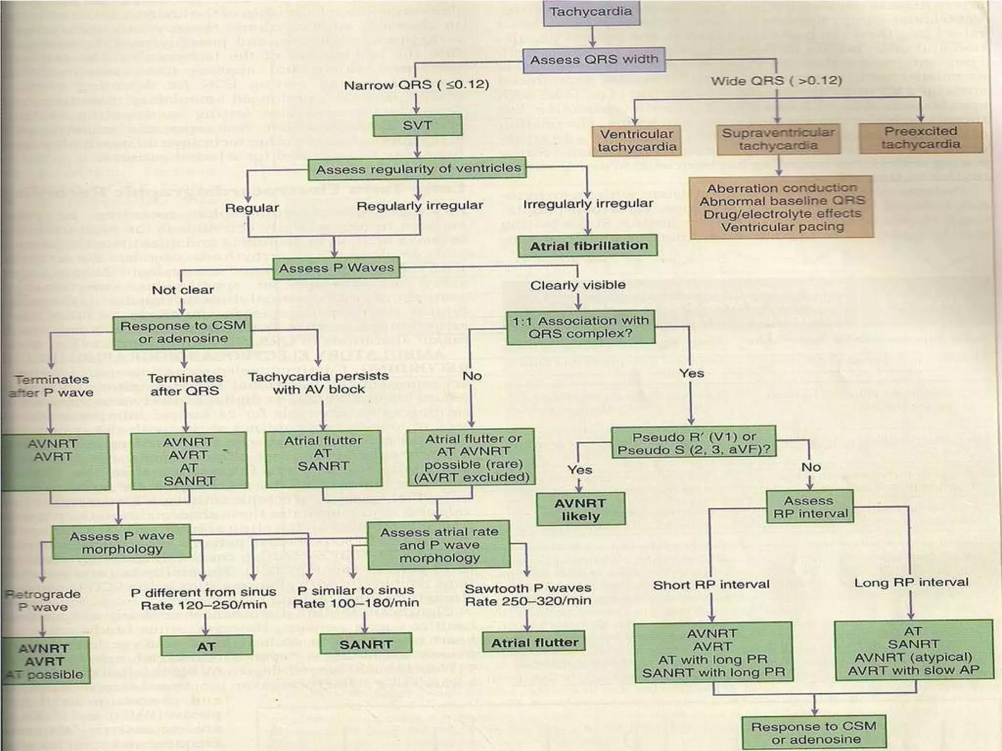 ECG: Narrow Complex Tachycardia | PPT