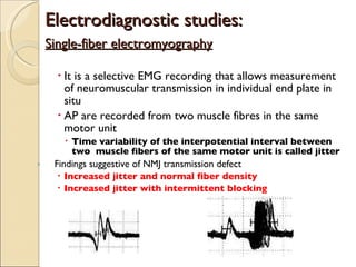Myasthenia Gravis - Management | PPT