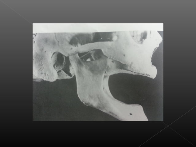 vertical jaw relation | PPT