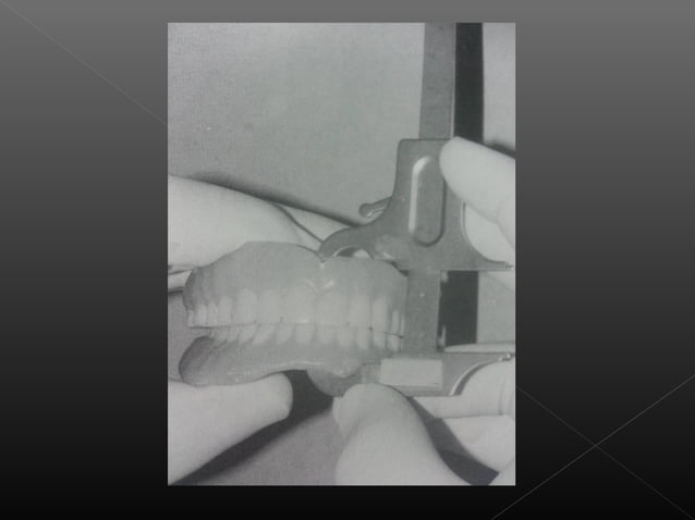 vertical jaw relation | PPT