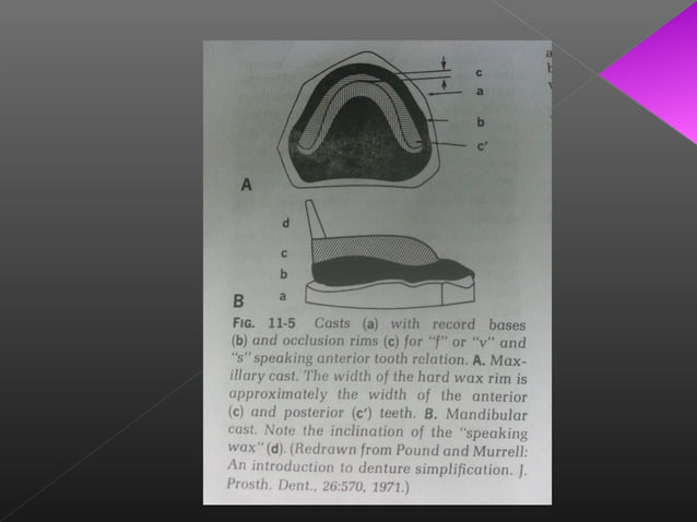 vertical jaw relation | PPT