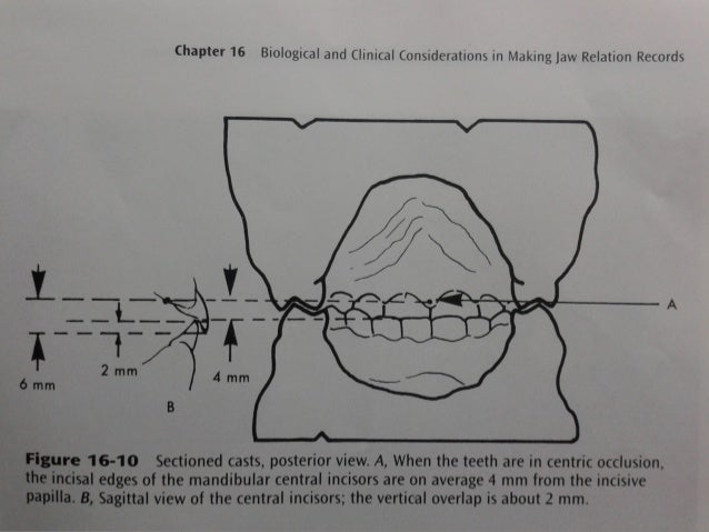 vertical jaw relation