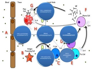 drug hypersensitivity made easy | PPTX