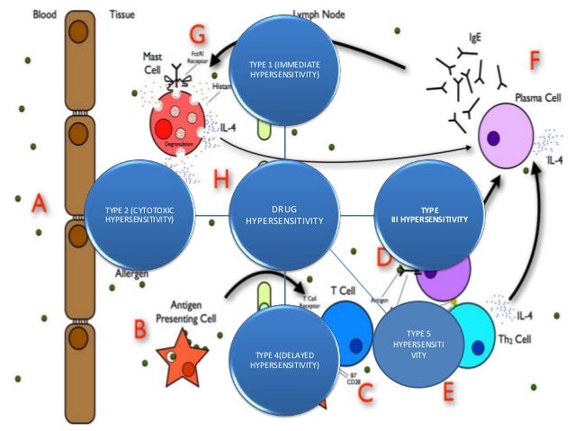 drug hypersensitivity