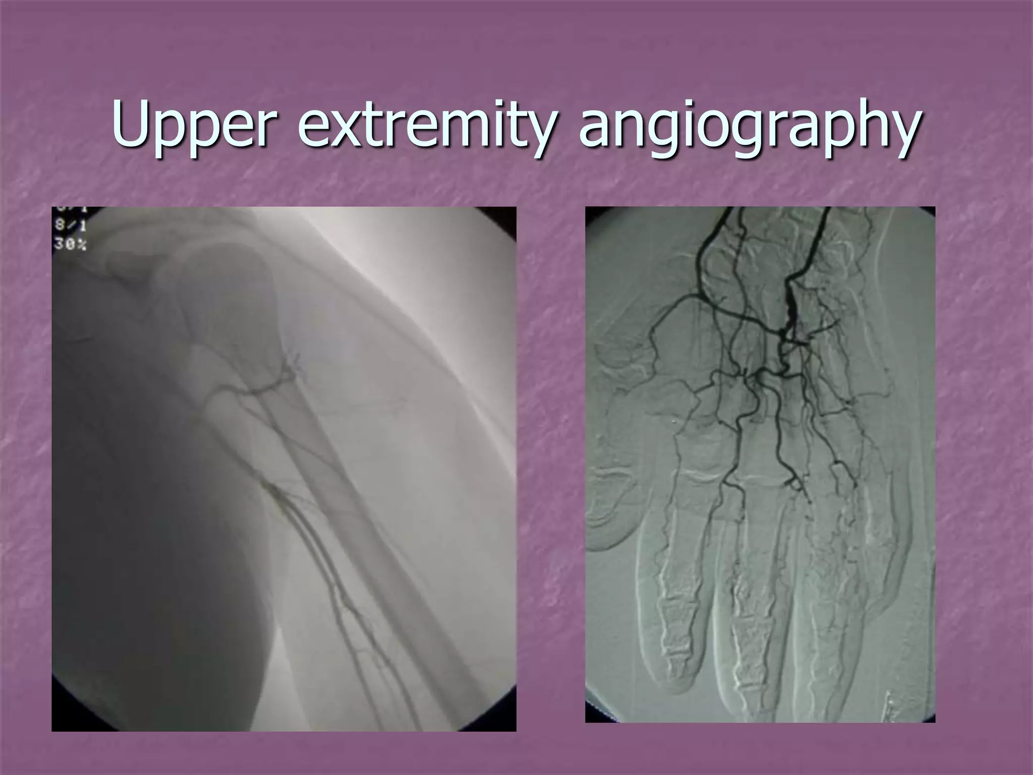 Introduction to Interventional Radiology.pptx
