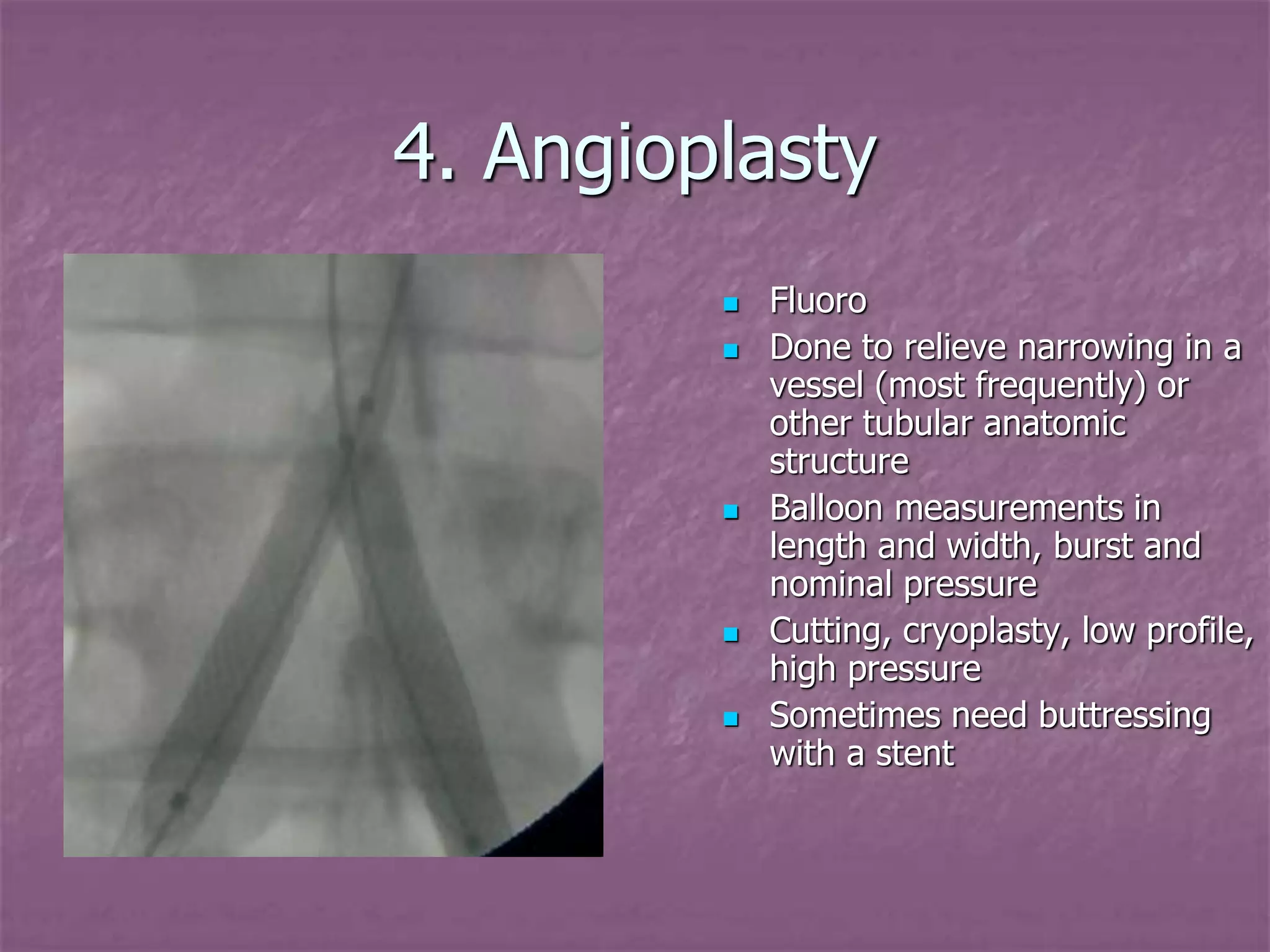 Introduction to Interventional Radiology.pptx