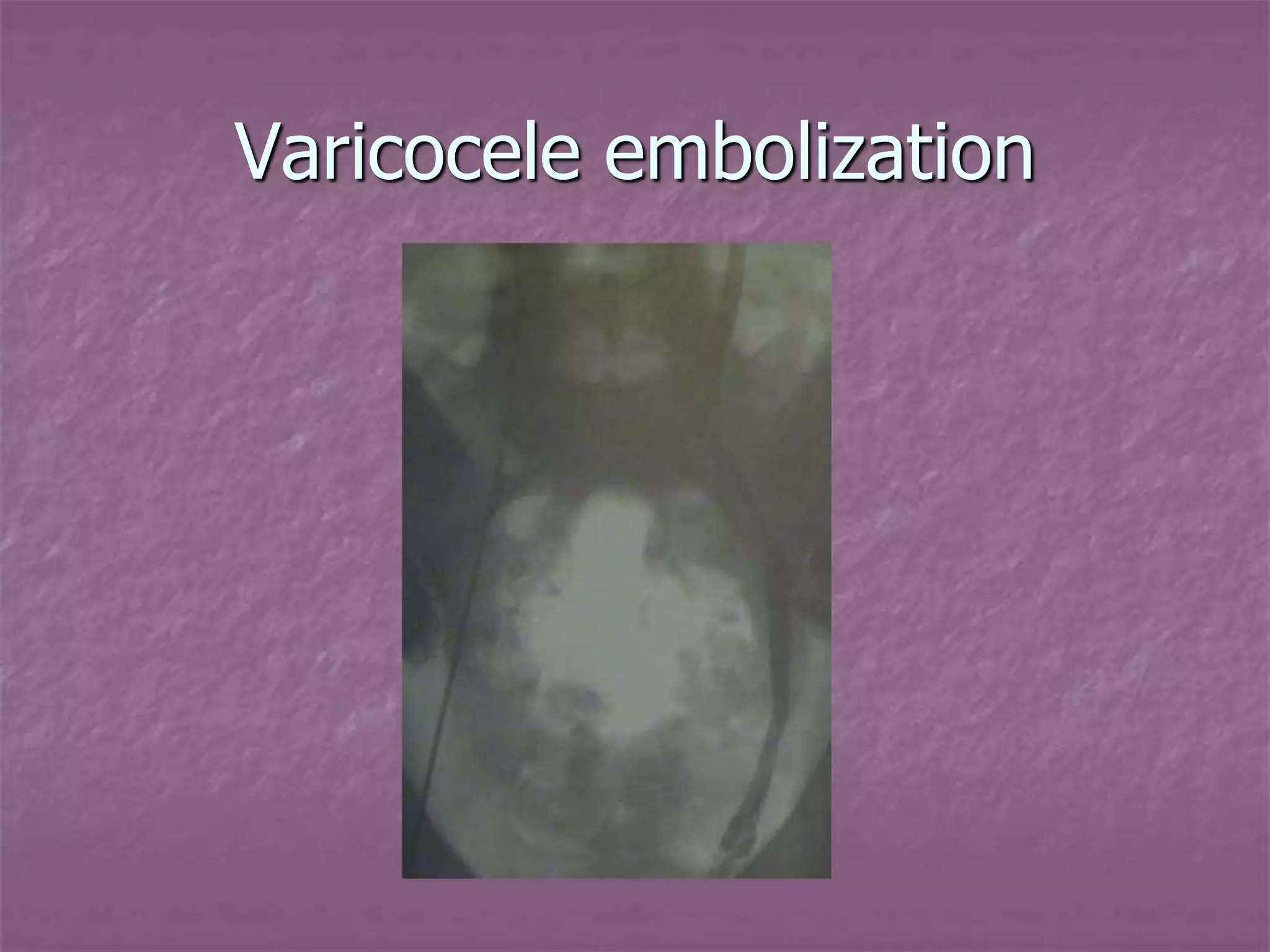 Introduction to Interventional Radiology.pptx