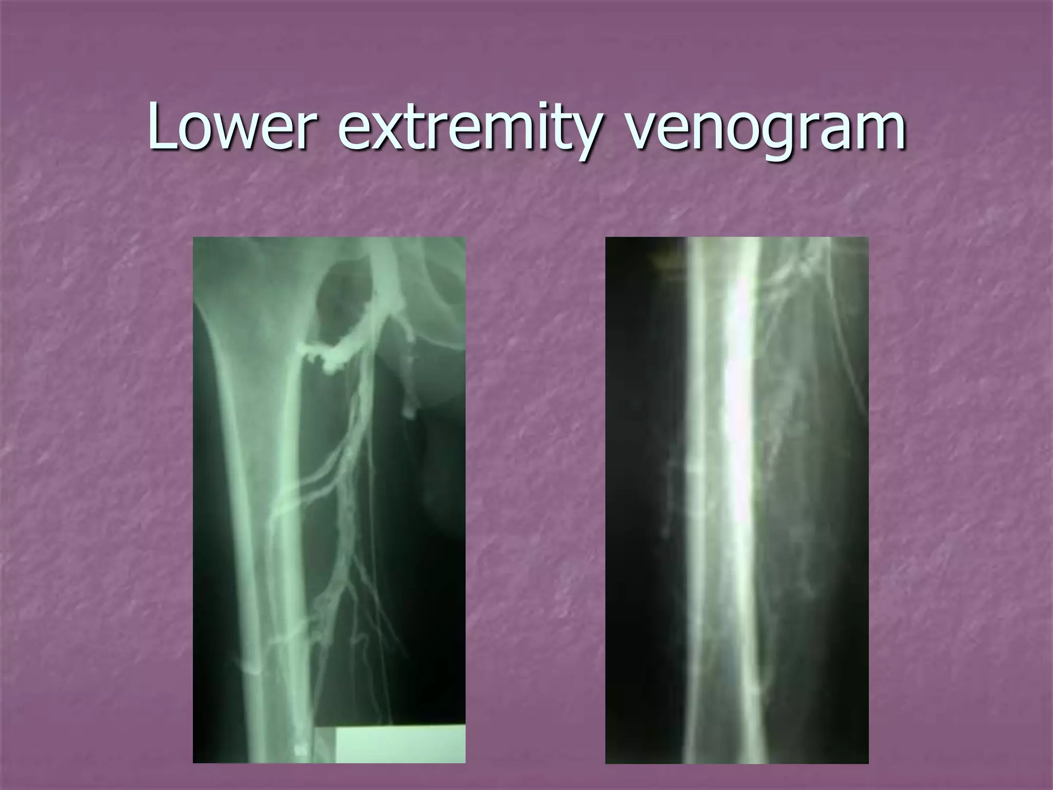 Introduction to Interventional Radiology.pptx