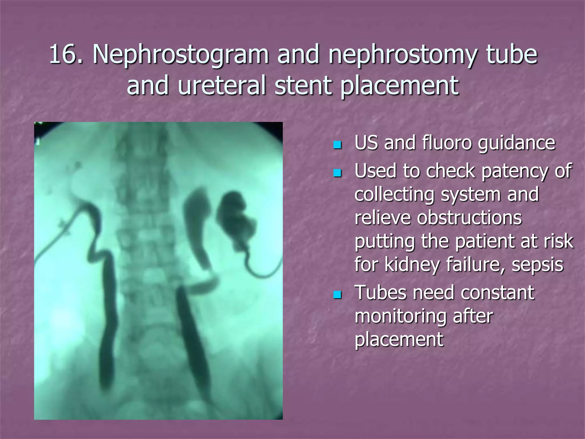 Introduction to Interventional Radiology.pptx