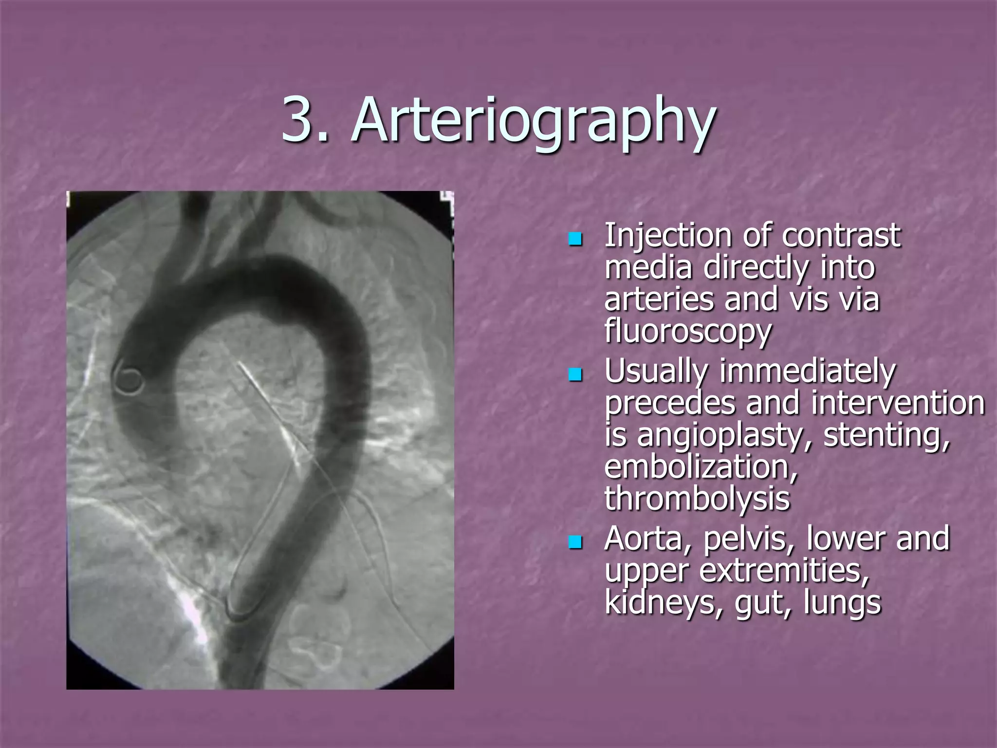 Introduction to Interventional Radiology.pptx