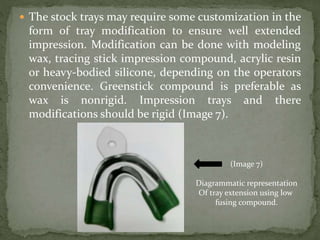 Alginate impression | PPTX