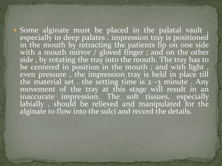 Alginate impression | PPTX