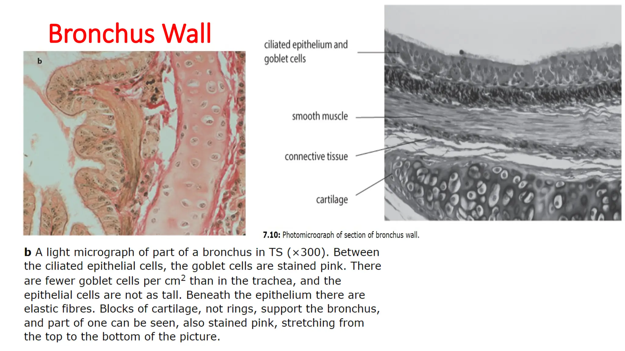 Gas Exchange Organs' Histology (Trachea, Bronchi, Bronchioles, Alveoli ...