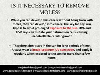 Mole removal | How to recognize if a mole is normal or suspicious ...