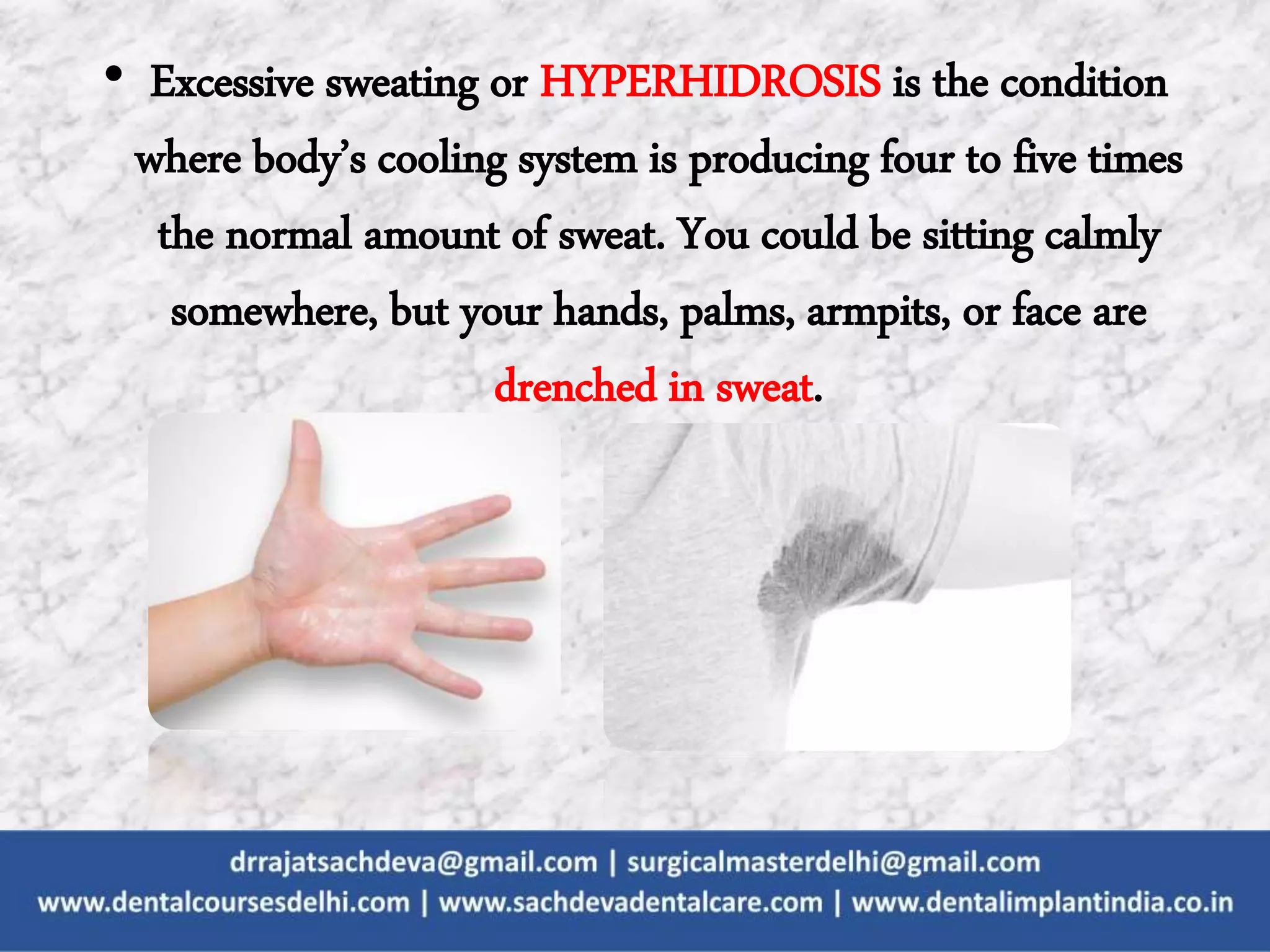 Hyperhidrosis | Excessive Sweating | PPTX