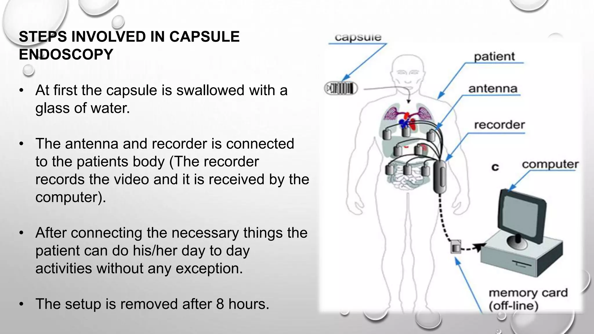 CAPSULE ENDOSCOPY | PPTX