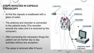 CAPSULE ENDOSCOPY | PPTX