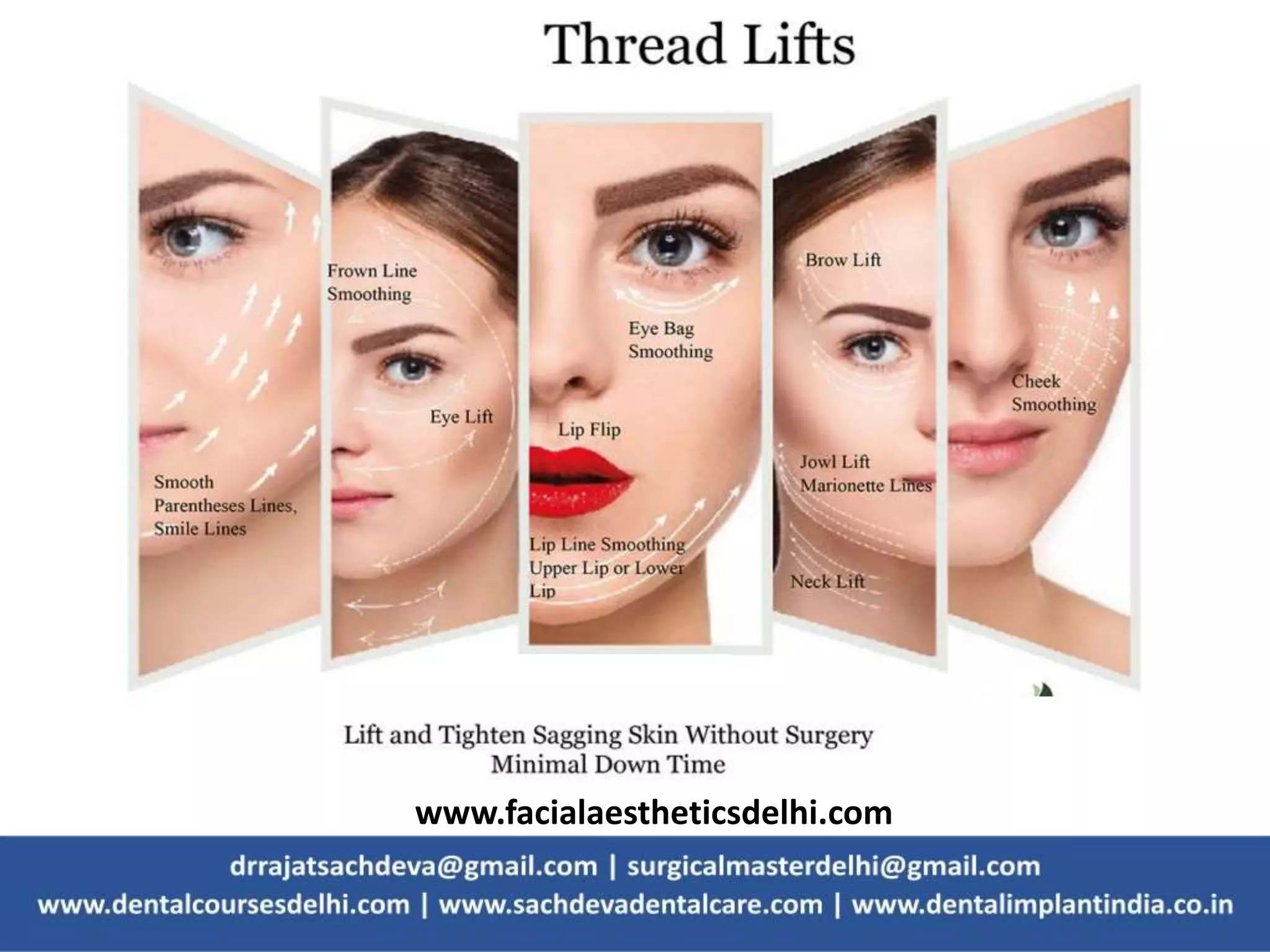 Cog | Face Lift Surgery | PPTX