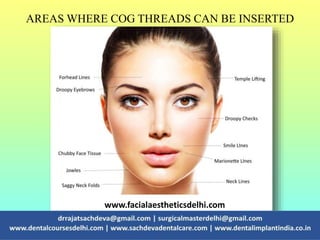 Cog | Face Lift Surgery | PPTX