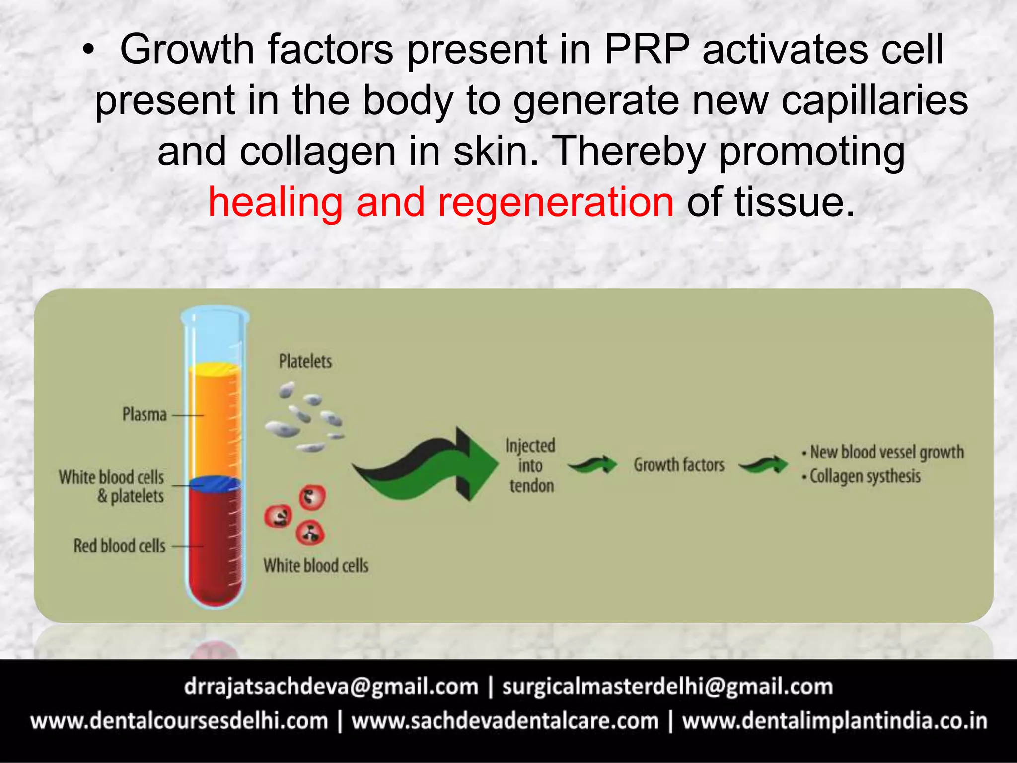 Prp Skin Rejuvenation | Platelet Rich Plasma | PRP and Vampire Facial ...