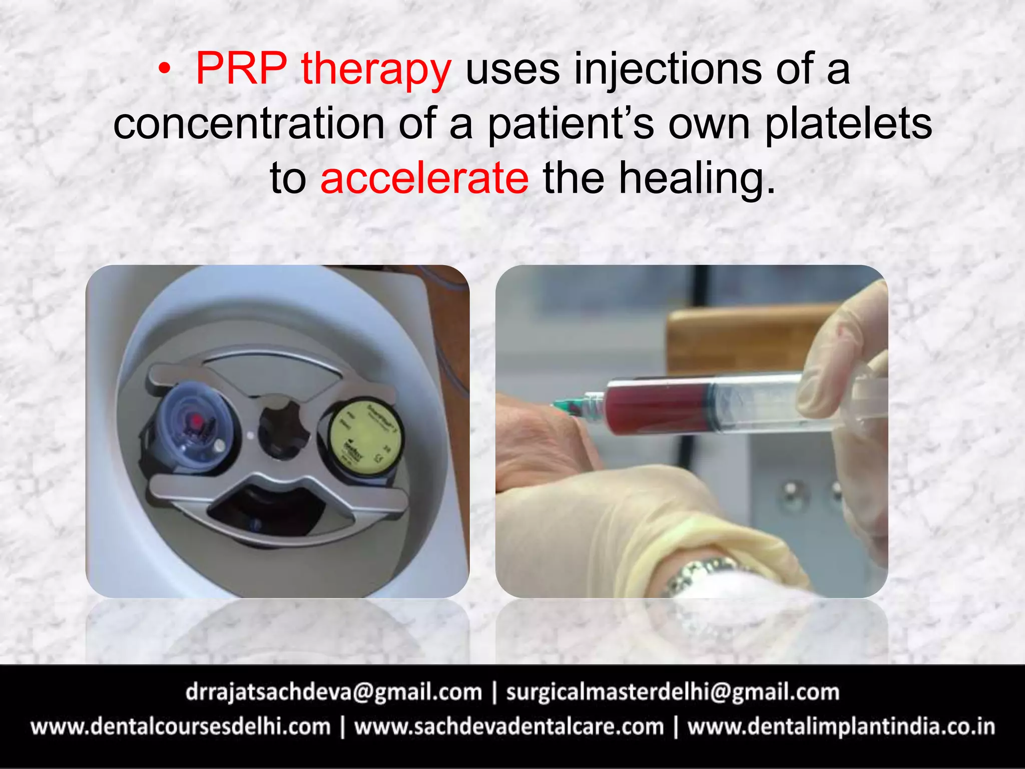 Prp Skin Rejuvenation | Platelet Rich Plasma | PRP and Vampire Facial ...