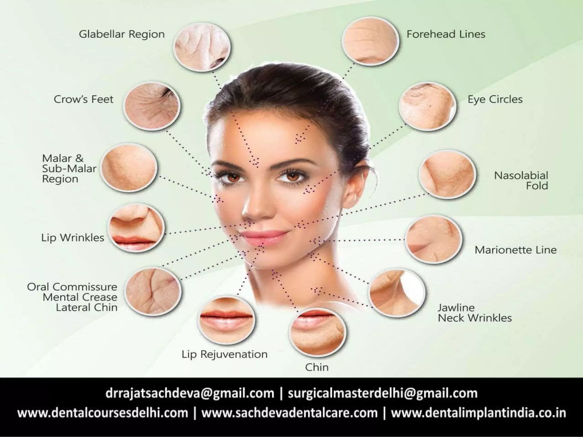 Prp Skin Rejuvenation | Platelet Rich Plasma | PRP and Vampire Facial ...