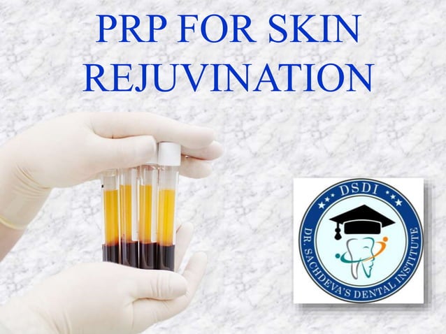 Prp Skin Rejuvenation | Platelet Rich Plasma | PRP and Vampire Facial ...