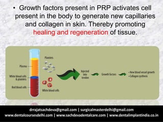 Prp Skin Rejuvenation | Platelet Rich Plasma | PRP and Vampire Facial ...