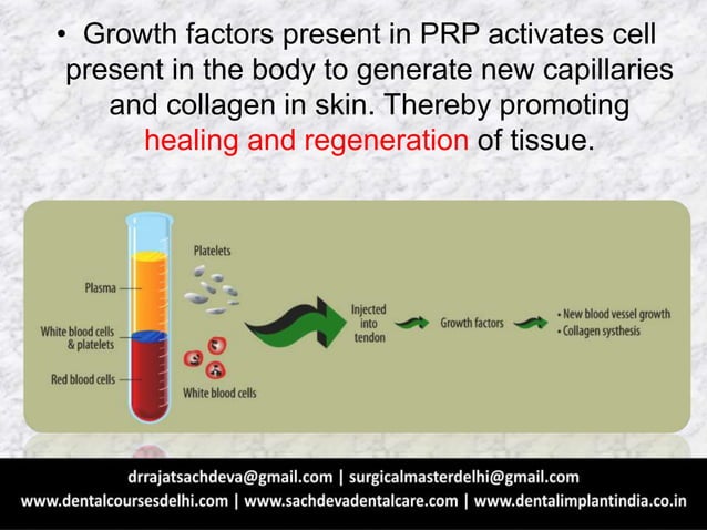 Prp Skin Rejuvenation | Platelet Rich Plasma | PRP and Vampire Facial ...