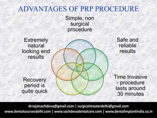 Prp Skin Rejuvenation | Platelet Rich Plasma | PRP and Vampire Facial ...